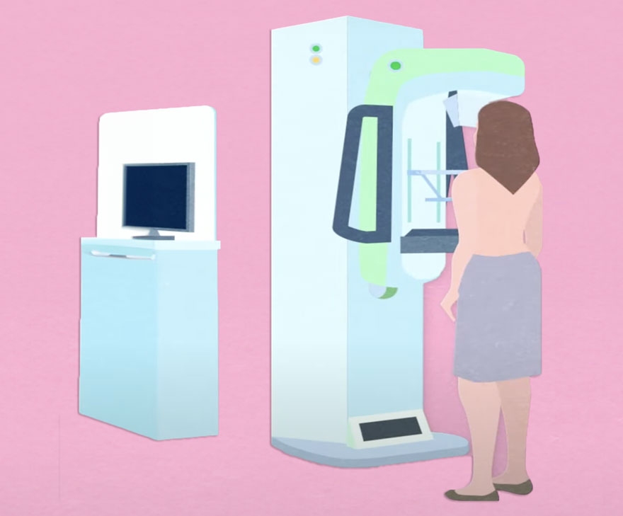 Screening Tests After a Mammogram | DenseBreast-info, Inc.